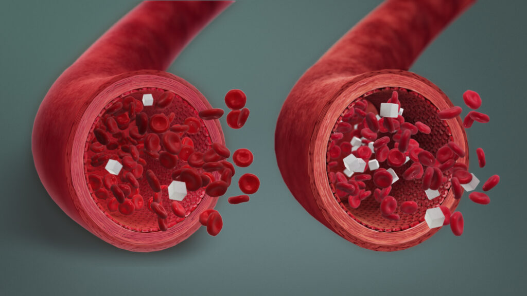 Hypoglycemia Medication : Types, Benefits and Management
