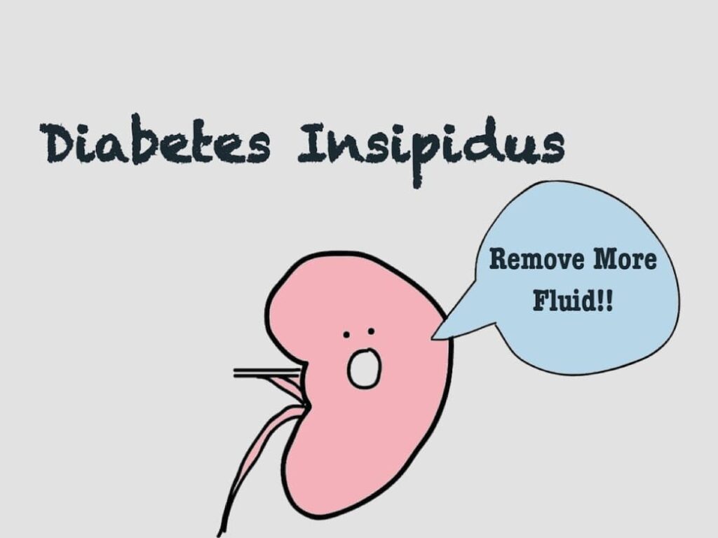 Diabetes Insipidus Cure : Explore all The Methods To Treat It